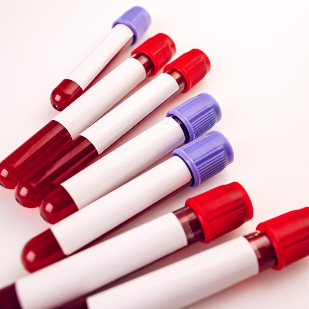 The Art of Making Blood Collection Less Stressful for Patients ...