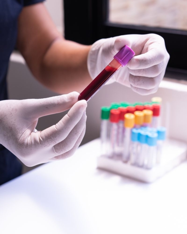 How to Label Tubes of Blood | PhlebotomyGifts.com